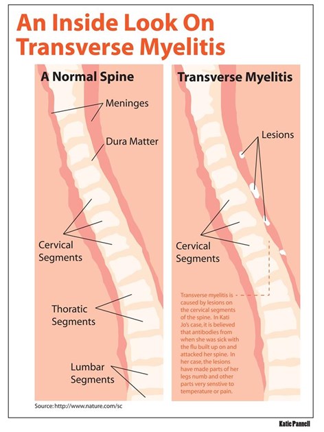 Annabel Jennings is fundraising for Transverse Myelitis Society
