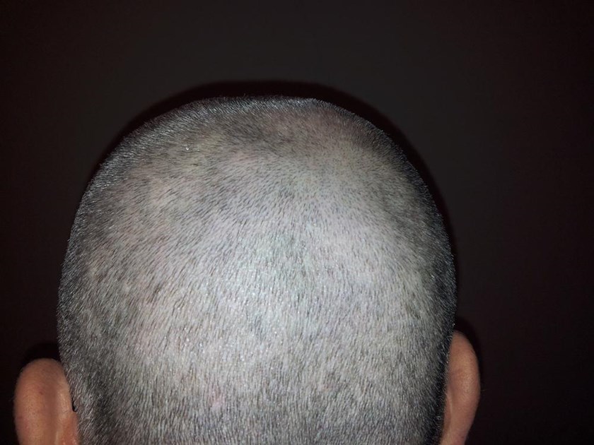 Adrian Melia is fundraising for The Brain Tumour Charity