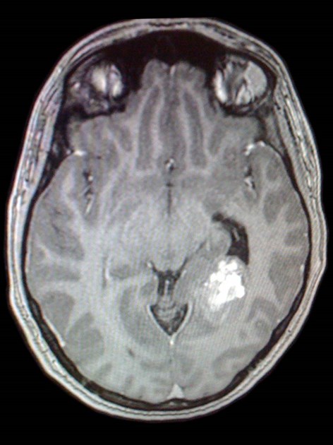 Lucy Sheppard is fundraising for Brain Tumour UK