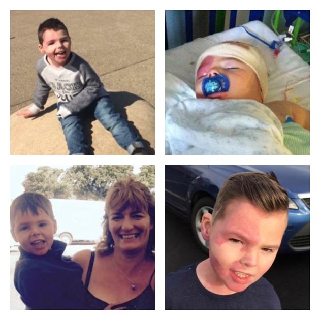 Tracey Hull is fundraising for Sturge Weber UK